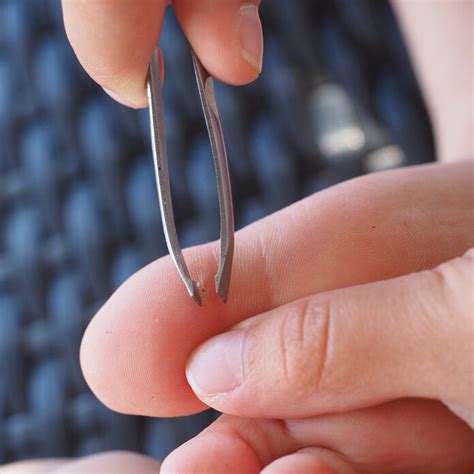 How To Get A Splinter Out Treatments You Can Do At Home