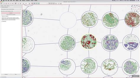 tma er analysis · qupath qupath wiki · github