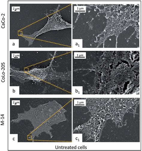 Representative FE SEM micrographs EHT ¼ kV and their Download Scientific Diagram