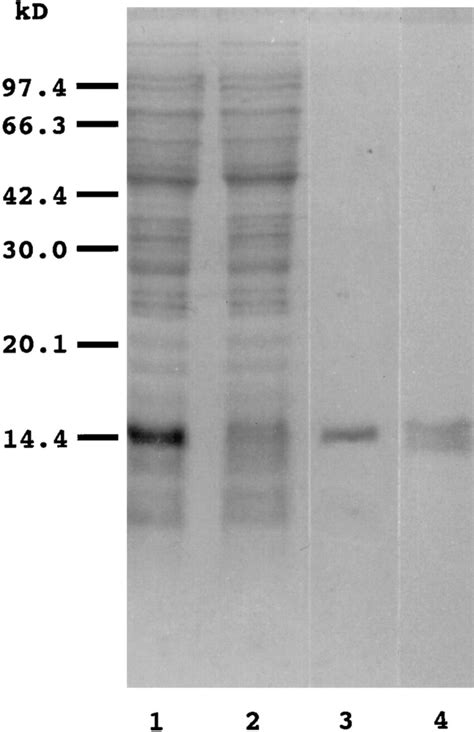 Expression And Purification Of A Histidinetagged Clostridium