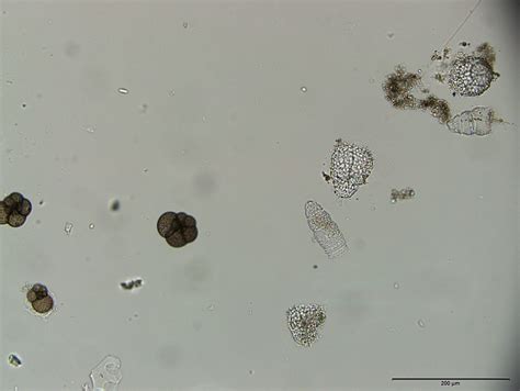 Foraminifera Under Microscope 100x