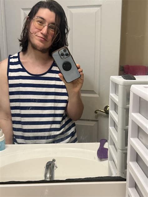 2 Weeks Post Op With Dr Liebman In Philly R Topsurgery