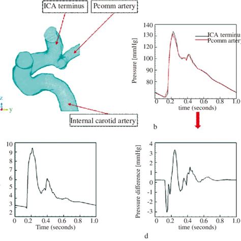 Inlet Boundary Condition For The Simulation A Anatomic Model B