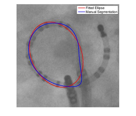 Illustration Of The Model Error For The First Frame Of Clinical Download Scientific Diagram