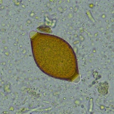 Pdf Concomitant Infection Of Trichuris Globulosa And Trichostrongylus Spp In A Dromedary Camel