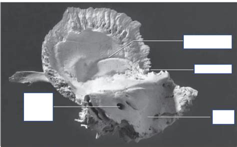 Right Temporal Medial Endocranial Diagram Quizlet