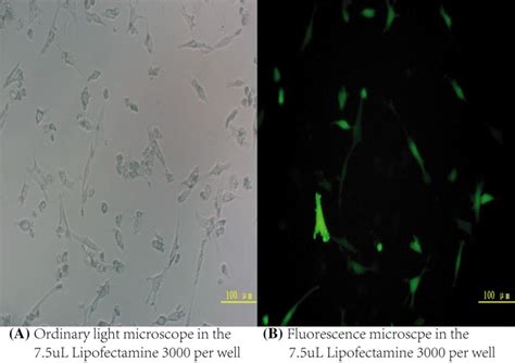 Fluorescence Microscope Observation Of 48 H Transfection In Each Group