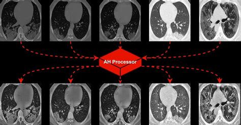 Adaptive Histogram Processor Processing Image Demonstration Download