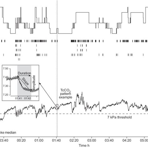 Overnight Transcutaneous Carbon Dioxide Tcco 2 And Arterial Oxygen Download Table