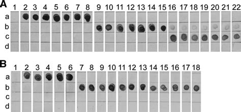 Assessment Of Multiplex Loop Mediated Isothermal Amplification