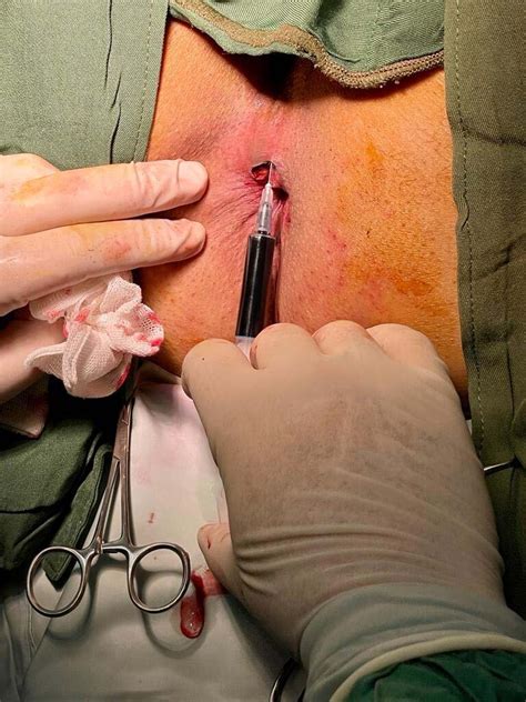 Intradermal Injection Of Methylene Blue Download Scientific Diagram