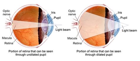 Retinal Diseases The American Society Of Retina Specialists