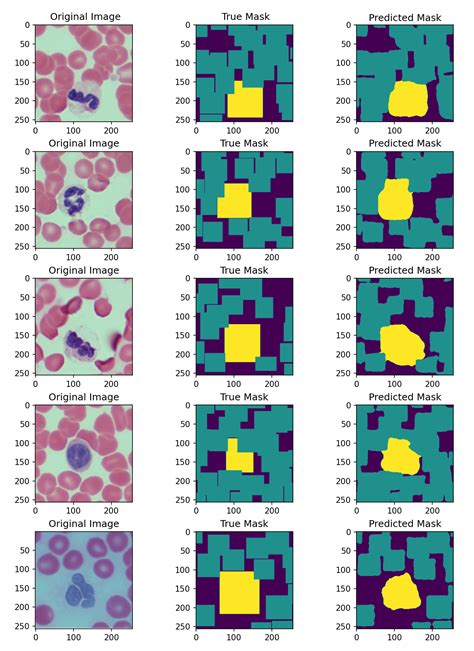 Github Dominosamblood Cells Segmentation Red And White Blood Cells