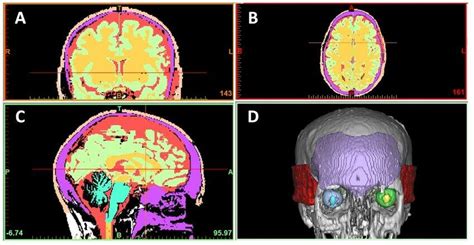 aioz 📖 guide3d a bi planar x ray dataset for guidewire segmentation