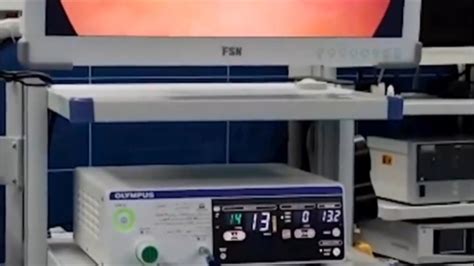 جراحی فتق بزرگ نماشا