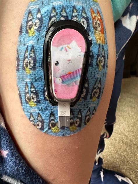 Dexcom G6 Grip Shield Lightweight TPU Restartable Etsy