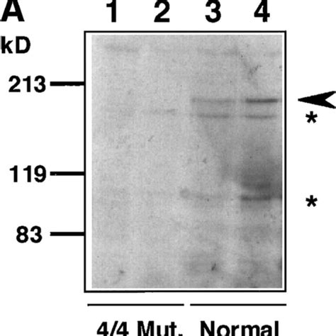 Comparison Of Levels Of Wrn Helicase Expression In Cells Of Normal