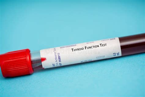 Thyroid Function Test Stock Image Image Of Hormones 275922689