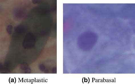 Examples Of Test Samples From The Sipakmed Pap Smear Dataset 9 Where Download Scientific