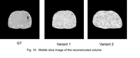 Four Dimensional Ct Using Implicit Neural Representation Preferred