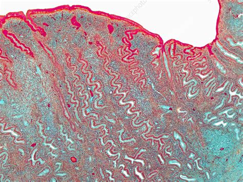 Human Uterus Light Micrograph Stock Image C055 6352 Science Photo Library