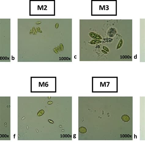 Microscopic Examination Of Rhodosporidium Toruloides And Tetradesmus