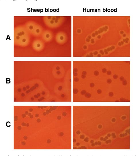 Staphylococcus Equorum Semantic Scholar