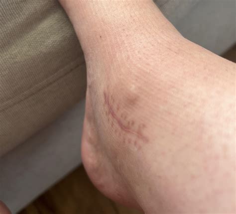 Projected Release Day R Orif