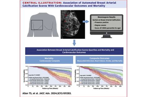 Using Mammograms To Detect Heart Disease