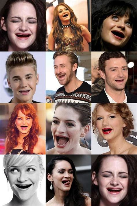 Justin Bieber Without Teeth