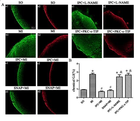 No And Pkc ε Promoted Chemical Gj Uncoupling During Ipc In Vivo Areas Download Scientific