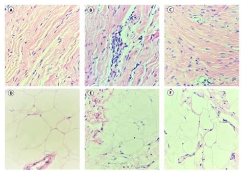 Comparative Effects Of Fractional Radiofrequency And Microneedling On The Genitalia Of