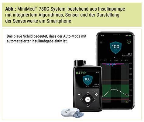 Was Können Heutige Closed Loop Systeme Diabetes Forum