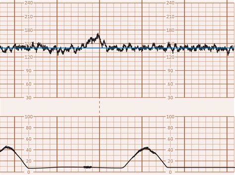 10 5 fetal heart rate monitoring nursing health promotion