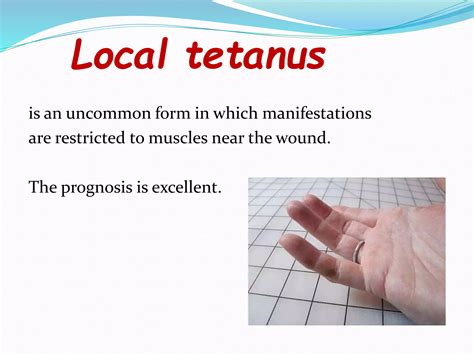 Tetanus Pptx