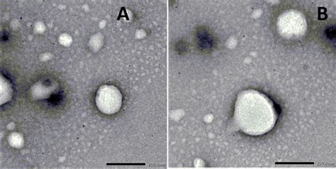 Tem Image Of Nanoparticles Of Eudragit Rs 100 A And Eudragit Rl 100 B Download Scientific