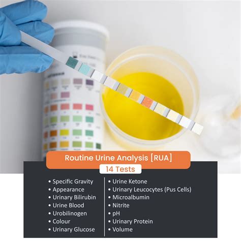 Routine Urine Analysis Healthcare Offers