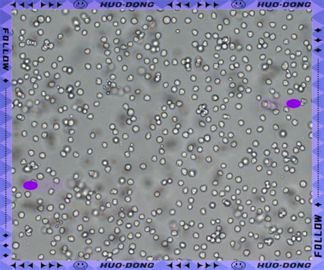 巨噬细胞m1 M2极化实验详解