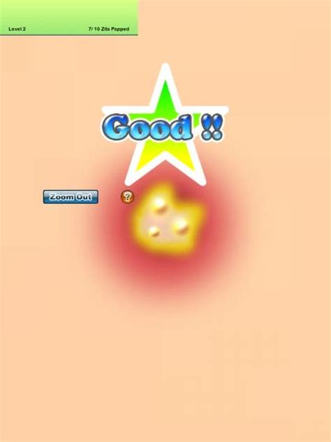 Pimple Popper For Iphone Download