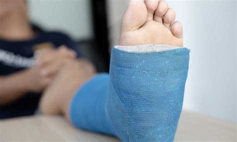 Comminuted Fracture Symptoms Causes And Treatment Blogs Author
