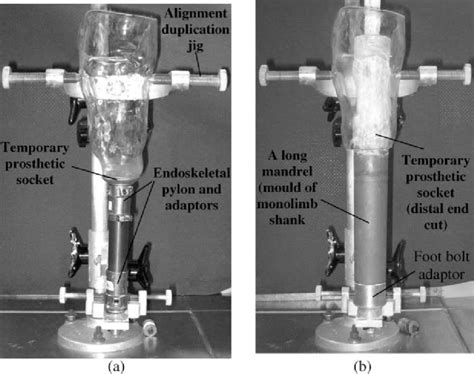 A A Temporary Prosthesis Is Put Into An Alignment Duplication Jig