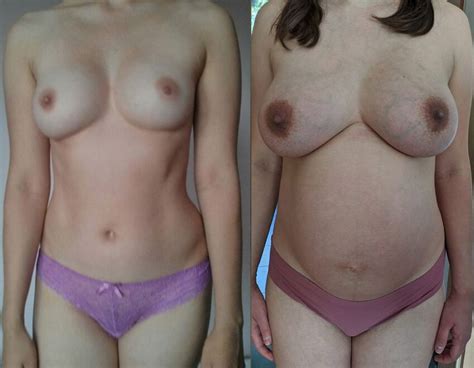 Before After Porn Pic Eporner