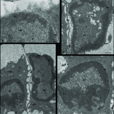 The Invaginations Of The Nuclear Envelope Of Propyzamide Treated