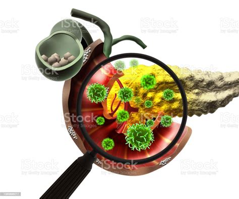 바이러스와 박테리아와 췌장 췌장 질환 개념 3d 일러스트레이션 0명에 대한 스톡 사진 및 기타 이미지 0명 3차원 형태