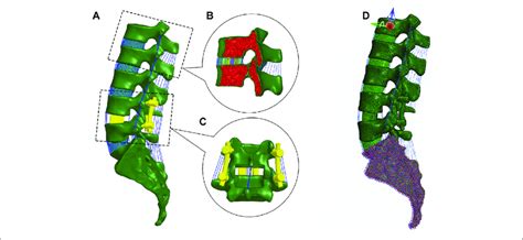 Finite Element Modeling A Lateral View Of The Lumbosacral Model Download Scientific