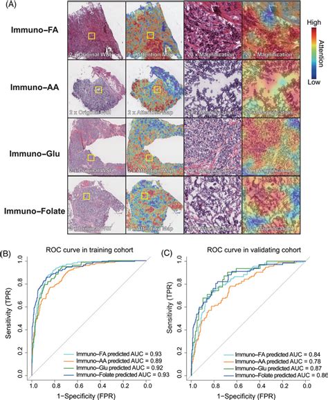 Multimodal Data Fusion Ai Model Uncovers Tumor Microenvironment Immunotyping Heterogeneity And