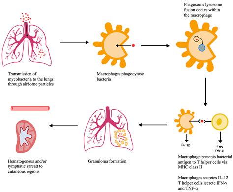 Cutaneous Manifestations Of Mycobacterium Tuberculosis A Literature Review