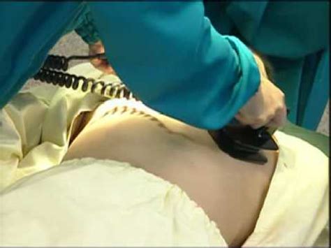 Defibrillator Save The Man S Life YouTube