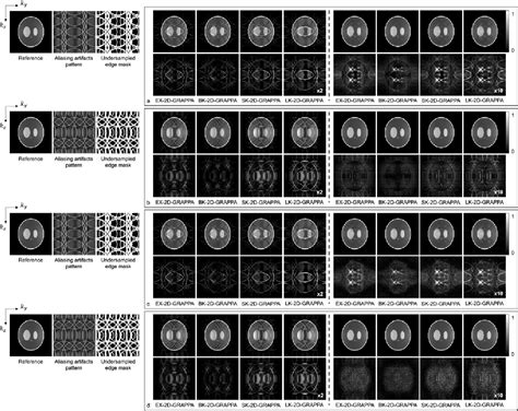 Figure 7 From A 2d Grappa Algorithm With A Boomerang Kernel For 3d Mri Data Accelerated Along