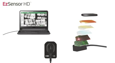 Ez Sensor Classic System Radiografii Cyfrowej Saiko Med